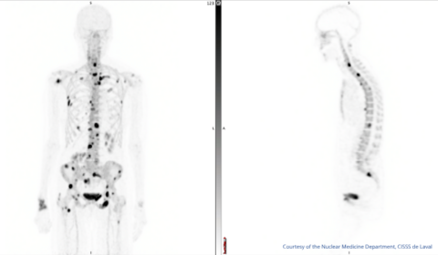 Products | Isologic Radiopharm